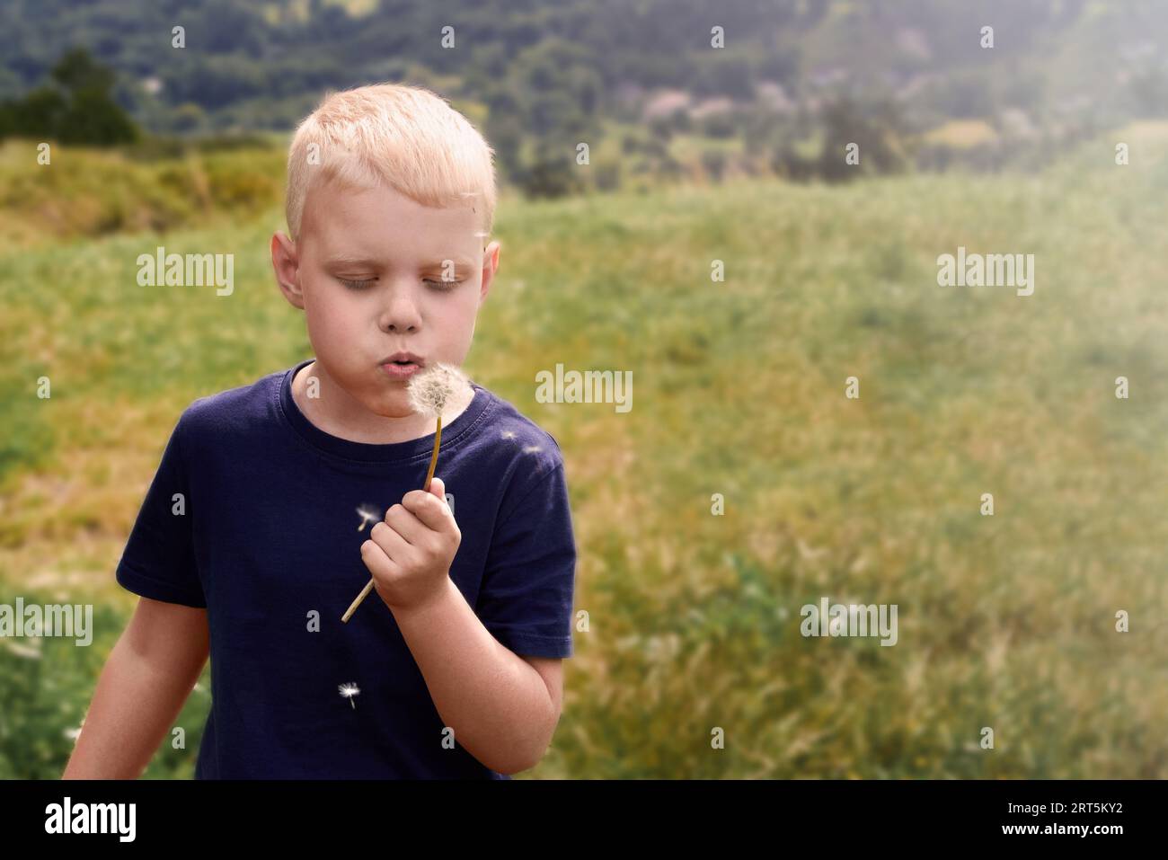 Effects of sunburn on human skin, exfoliation of dry skin, close-up ...