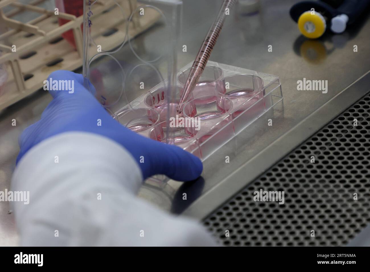 Human embryo 8 cell stage hi-res stock photography and images - Alamy