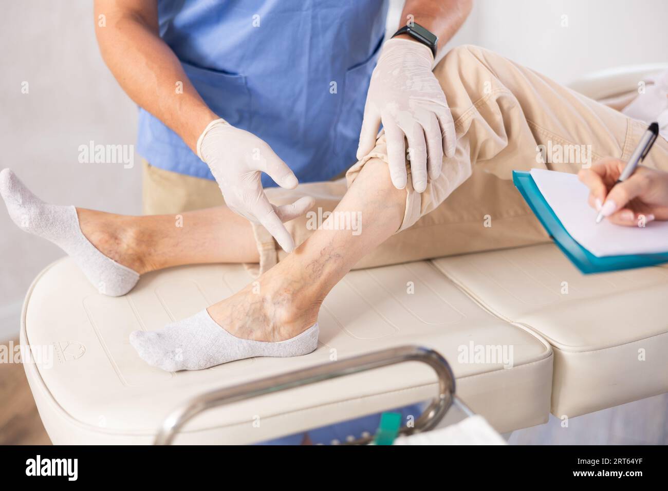 Professional phlebologists examining female legs with signs of varicose ...