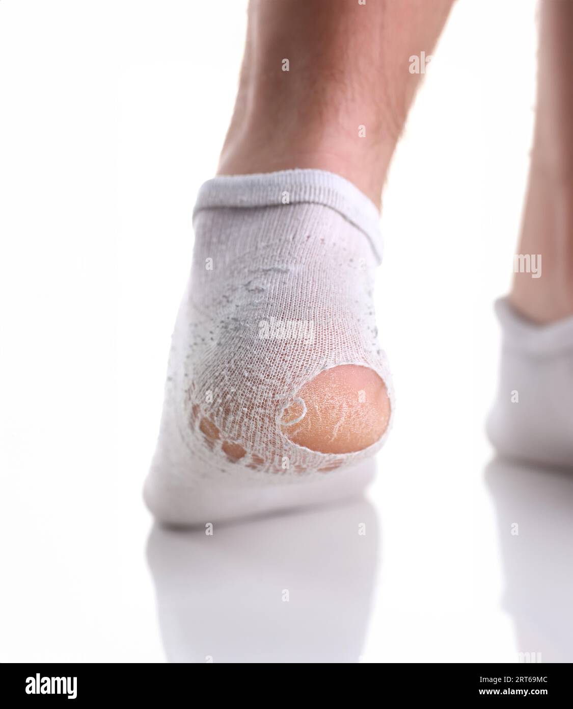 Ripped white sock on male leg isolated Stock Photo - Alamy
