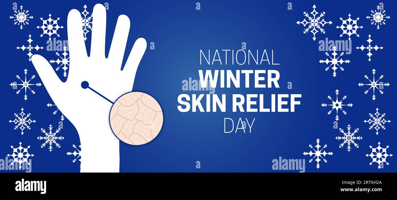 National Winter Skin Relief Day Background Illustration with Dry Hand ...