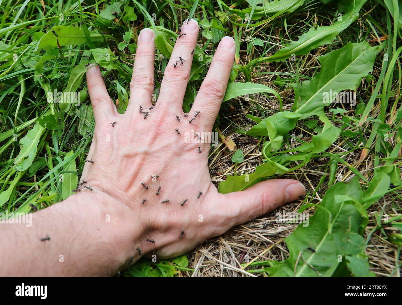 hand of person with black ants above that bite and sting and cause ...