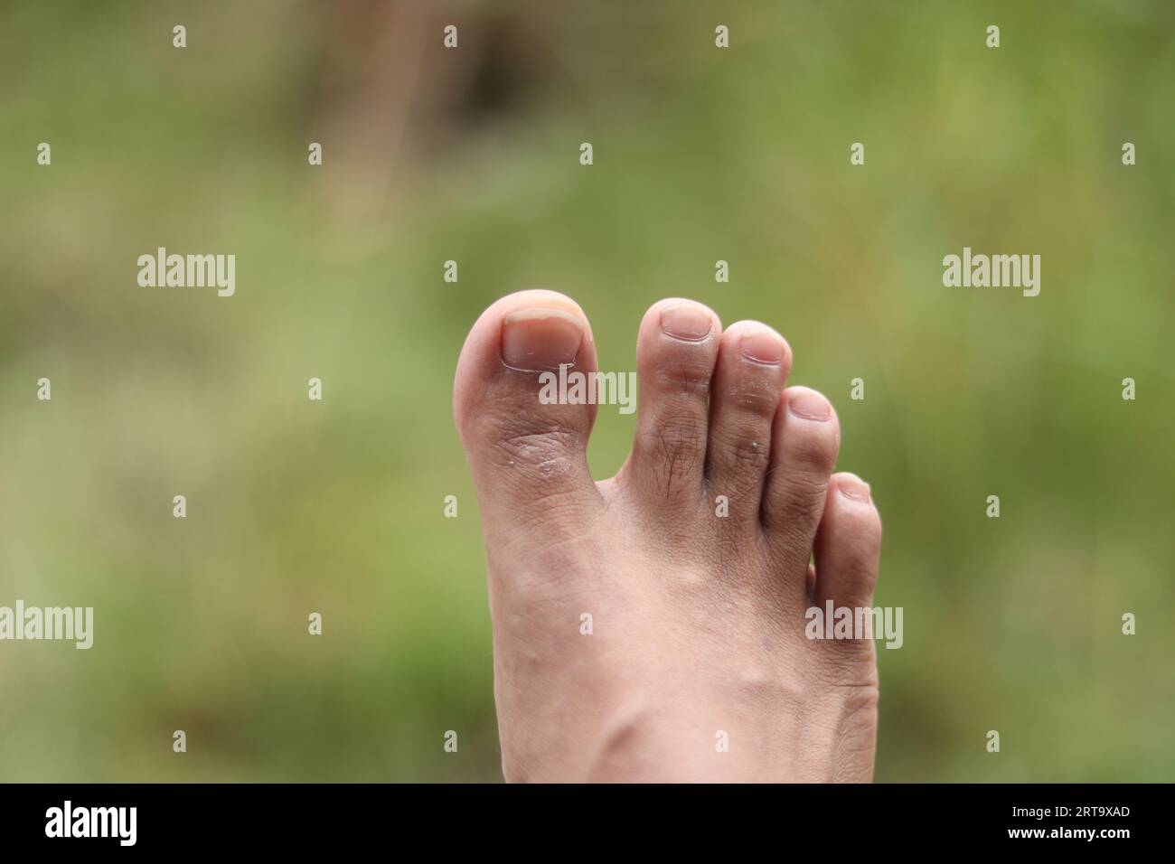 Raised right foot hi-res stock photography and images - Alamy