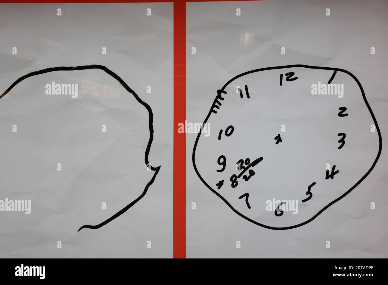 The clock drawing tests conducted by elderly people with Alzheimer's ...