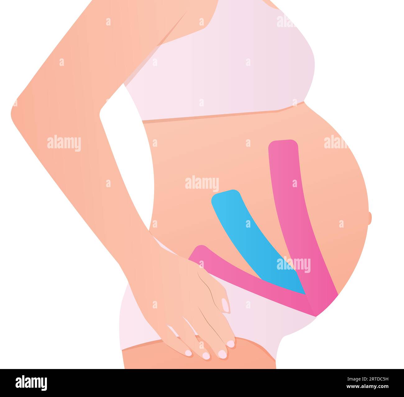 kinesio taping on pregnant woman -vector illustration Stock Vector ... kinesio taping on pregnant woman -vector illustration Stock Vector ...
