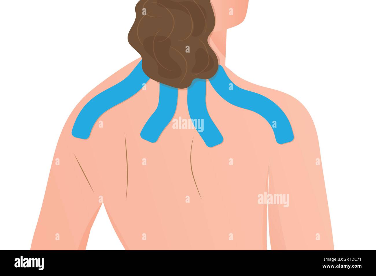 kinesiology taping on woman back- vector illustration Stock Vector ...
