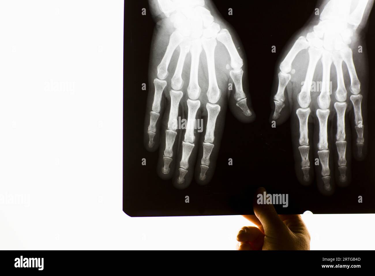 Hand of healthcare professional holding x-ray of a pair hands Stock ...