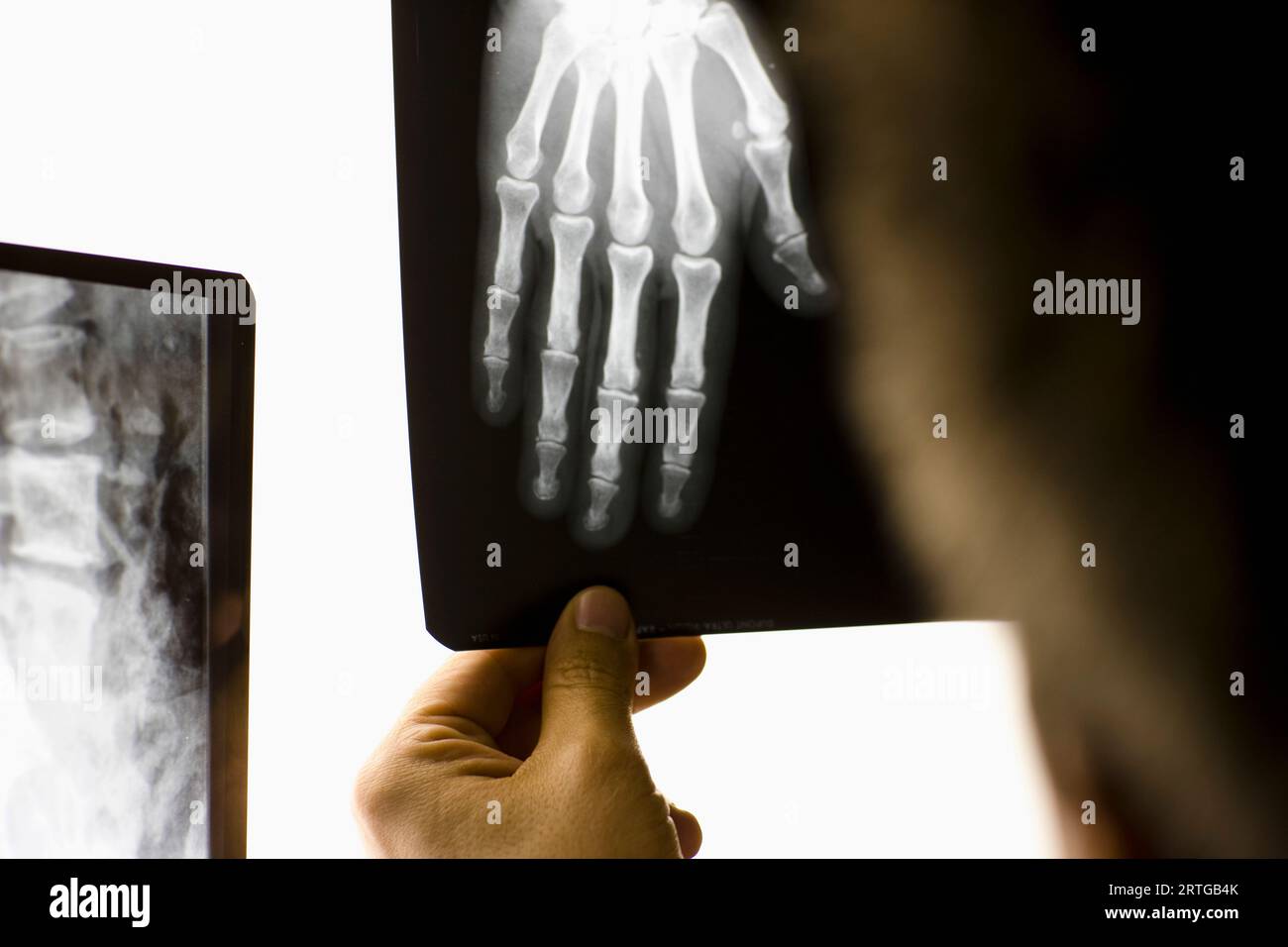 Hand of healthcare professional holding x-ray of a hand Stock Photo - Alamy