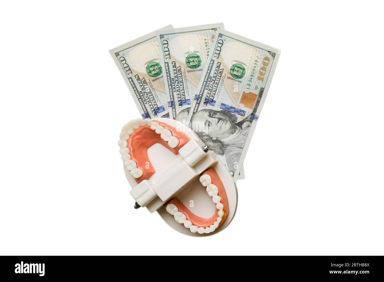 Closeup model of a human jaw with white teeth and dollar bill ...
