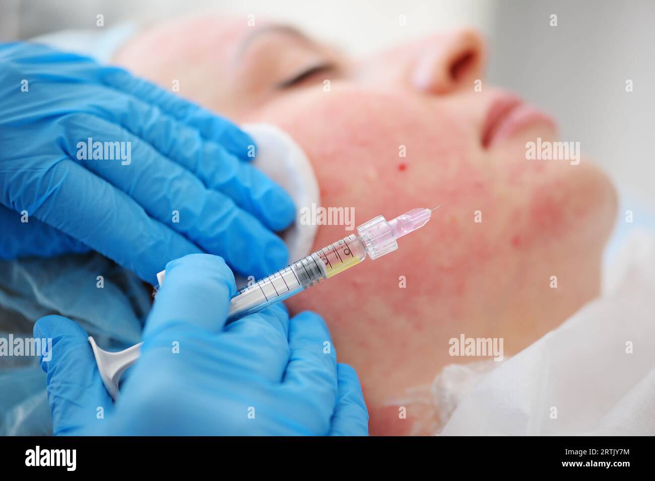 cosmetologist injects an injection of his own platelet-rich blood ...