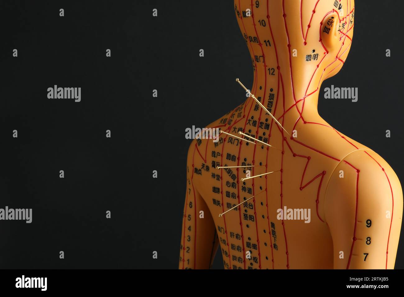 Acupuncture - alternative medicine. Human model with needles in back ...