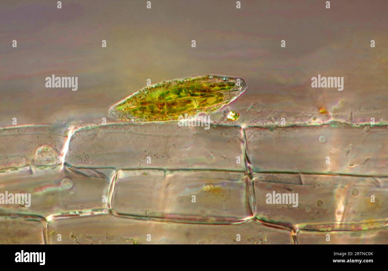 Diatoms Under Microscope 400x 540+ Diatom Algae Stock Videos And
