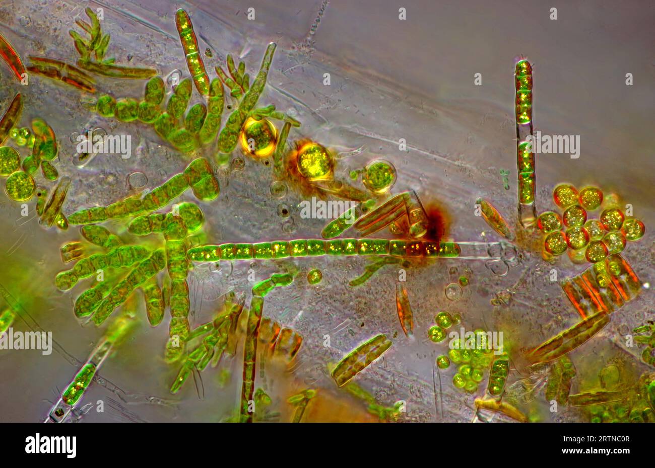 The image presents various tiny algae settled on Lemna sp. root ...