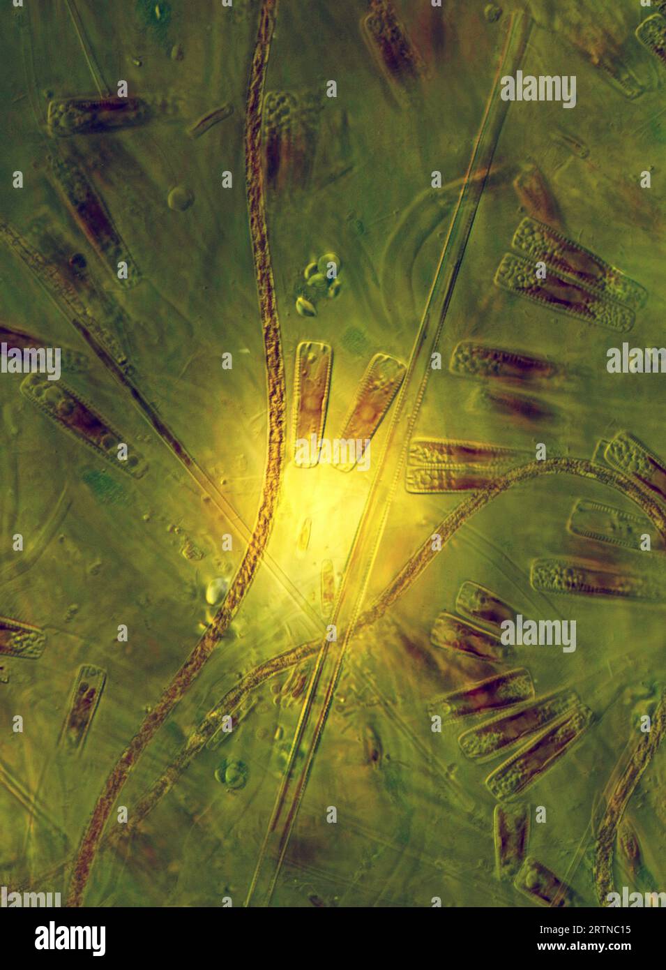 Diatoms hi-res stock photography and images - Alamy