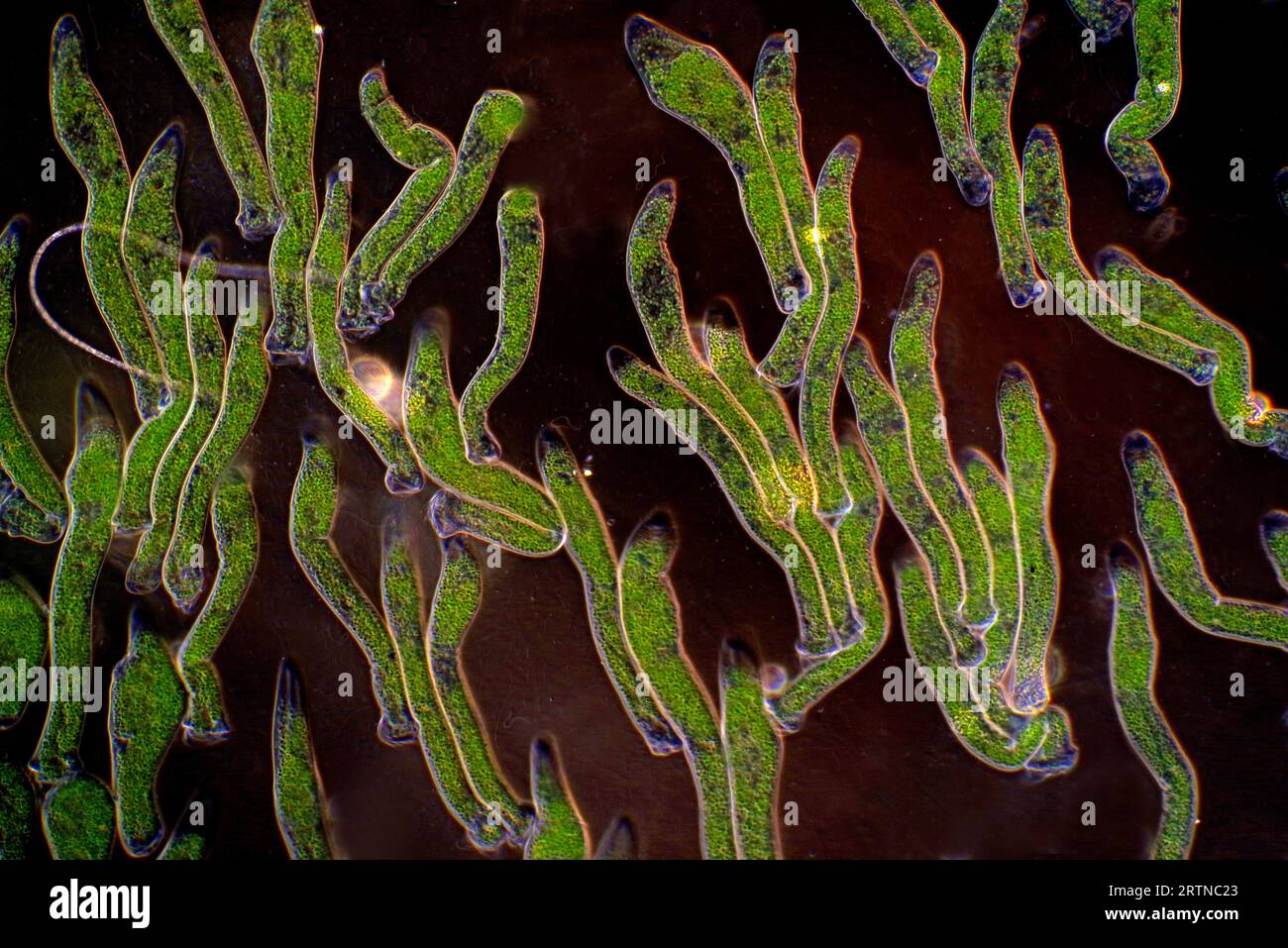 The image presents Ophrydium sp. ( a kind of colonial ciliates ...