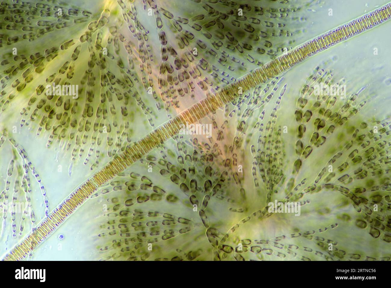 The image presents Batrachospermum sp., a kind of red algae and ...