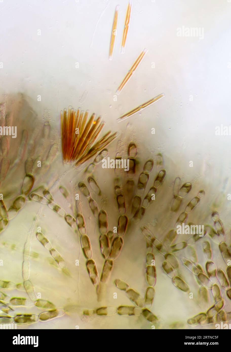 Algae microscope hi-res stock photography and images - Alamy