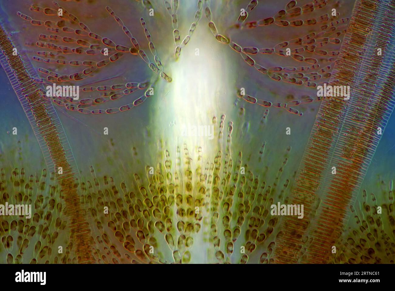 The image presents Fragilaria sp., a kind of diatoms against ...