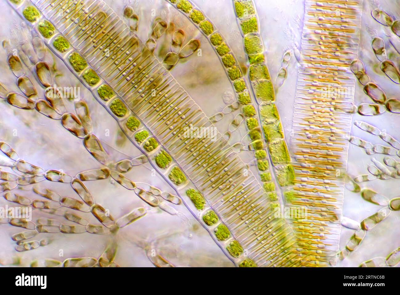 The image presents various algae (Fragilaria sp., a kind of diatoms ...