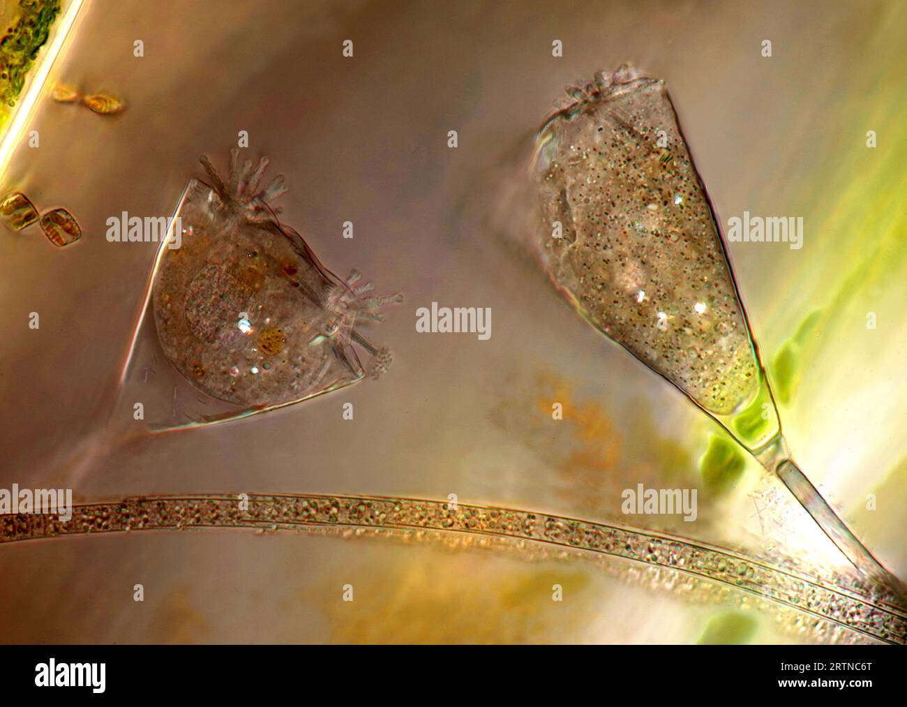 The image presentstwo suctorians ( a kind of ciliate), photographed ...