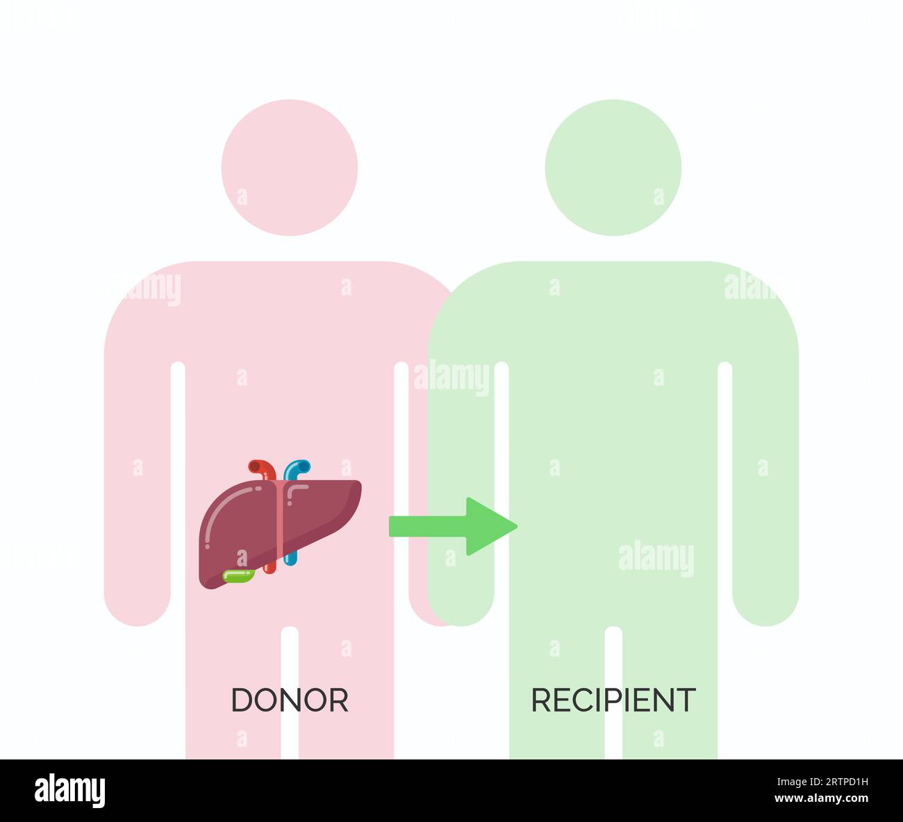 Human organ transplantation concept. Vector illustration of donor and ...