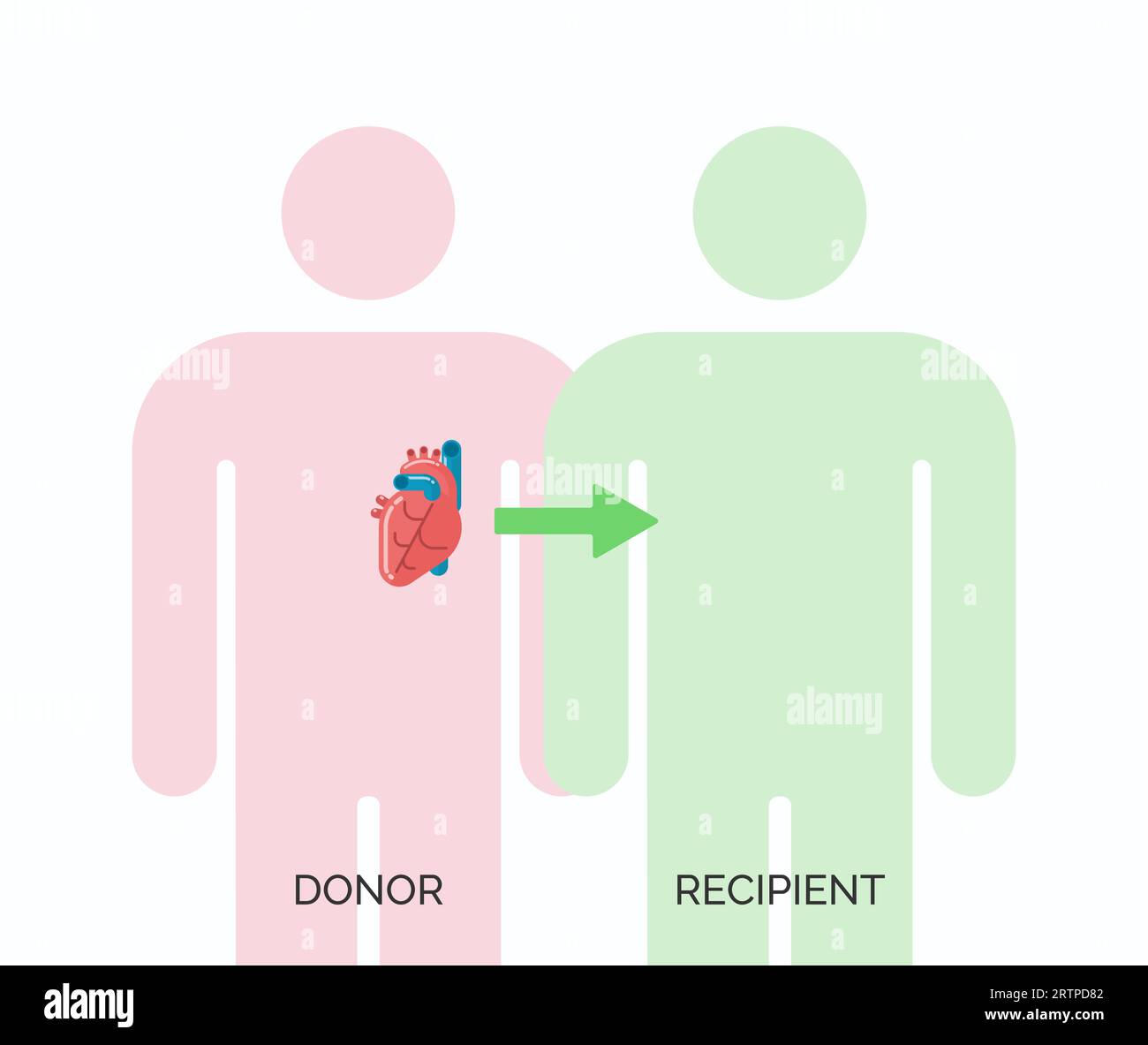 Human organ transplantation concept. Vector illustration of donor and ...