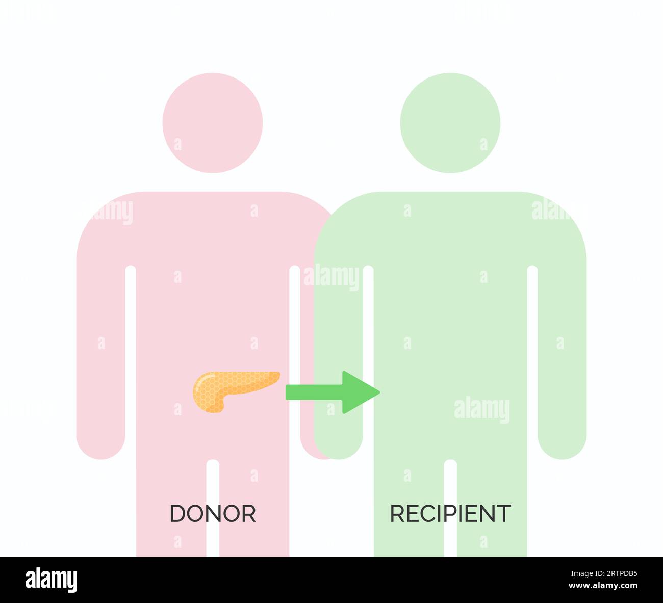 Human organ transplantation concept. Vector illustration of donor and ...
