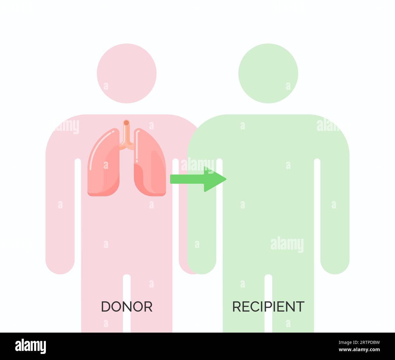 Human organ transplantation concept. Vector illustration of donor and ...