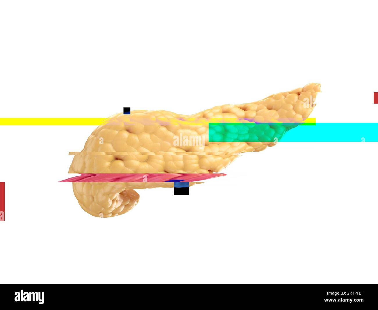 Realistic 3d illustration of anatomical model of human pancreas with ...