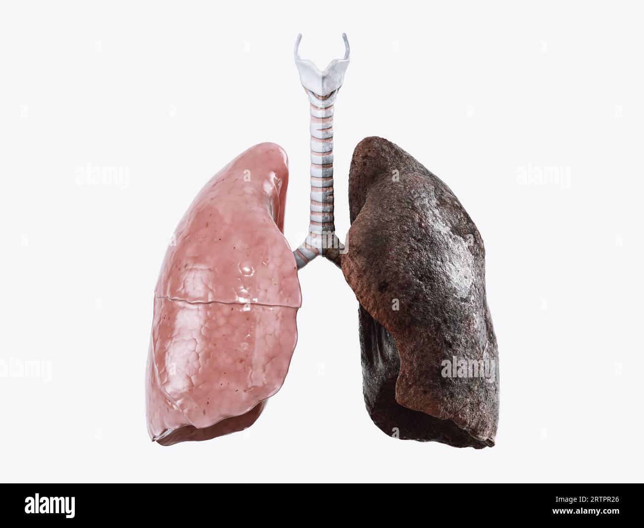 Realistic 3d illustration of healthy human lungs vs smoker lungs ...