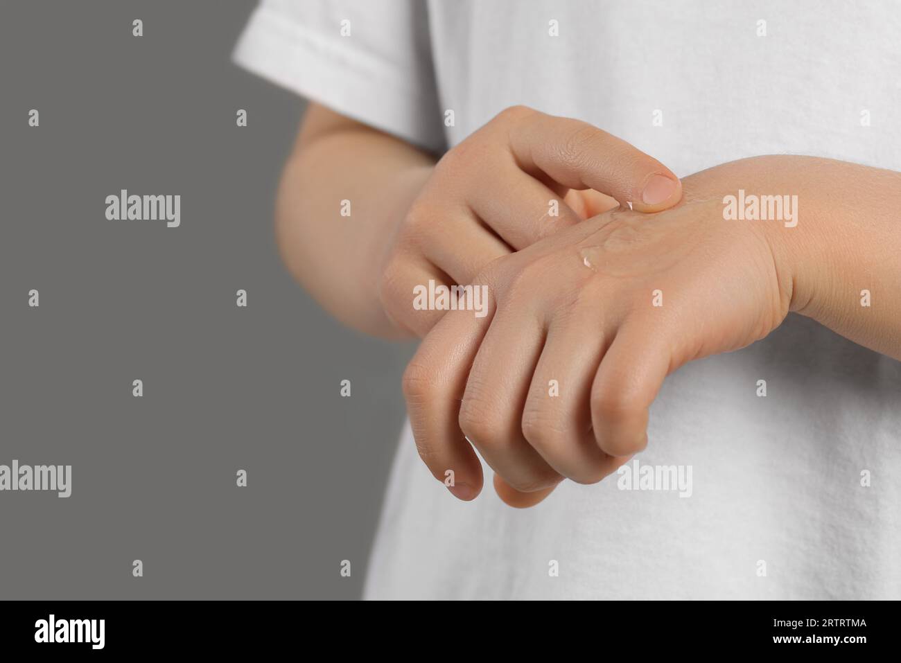 Child applying ointment onto hand against grey background, closeup ...