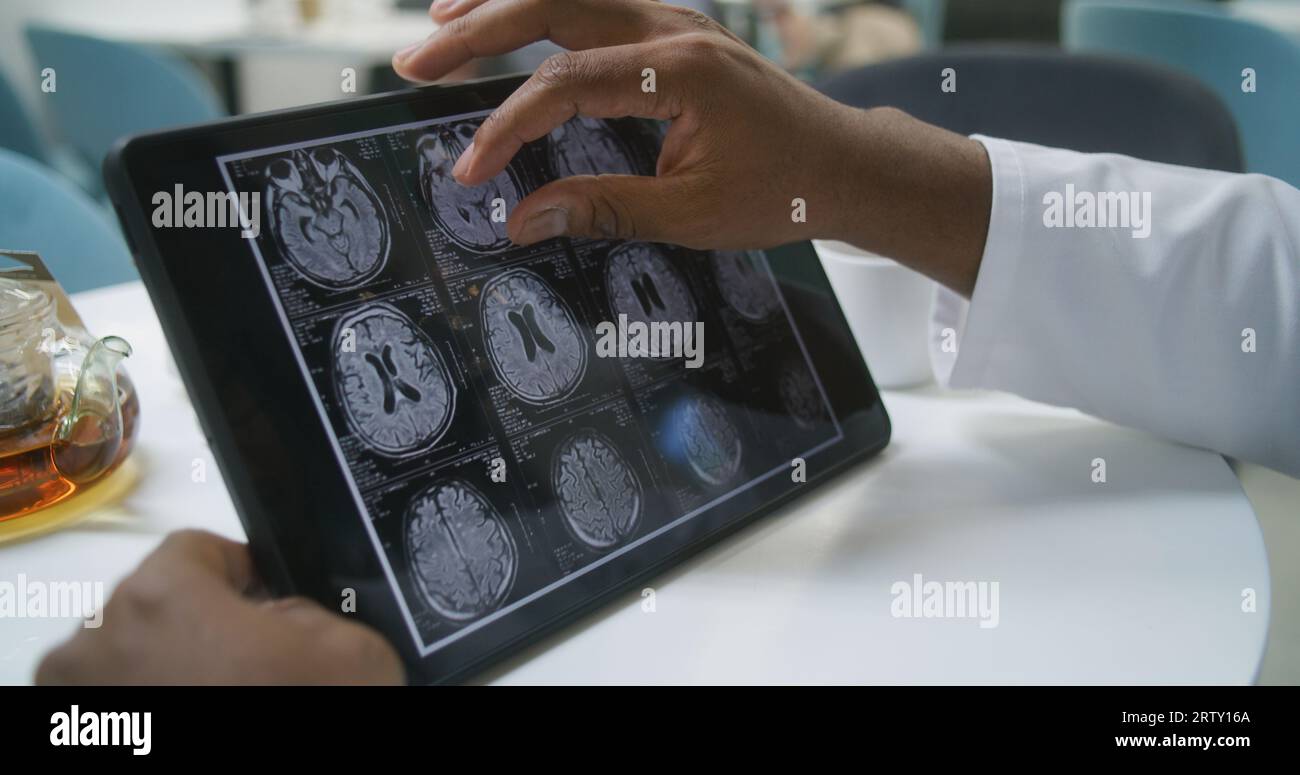 Close mri ray images results hi-res stock photography and images - Alamy