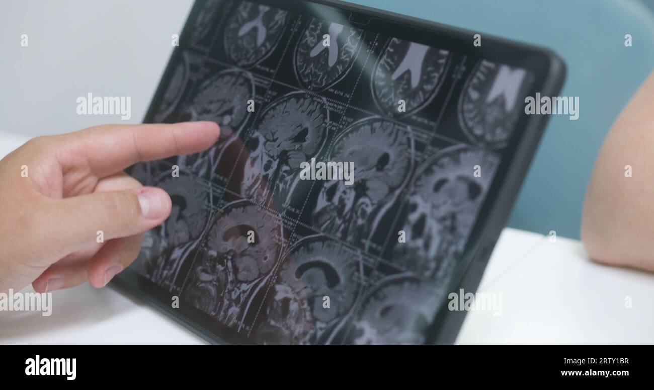 Cafe x ray examination hi-res stock photography and images - Alamy