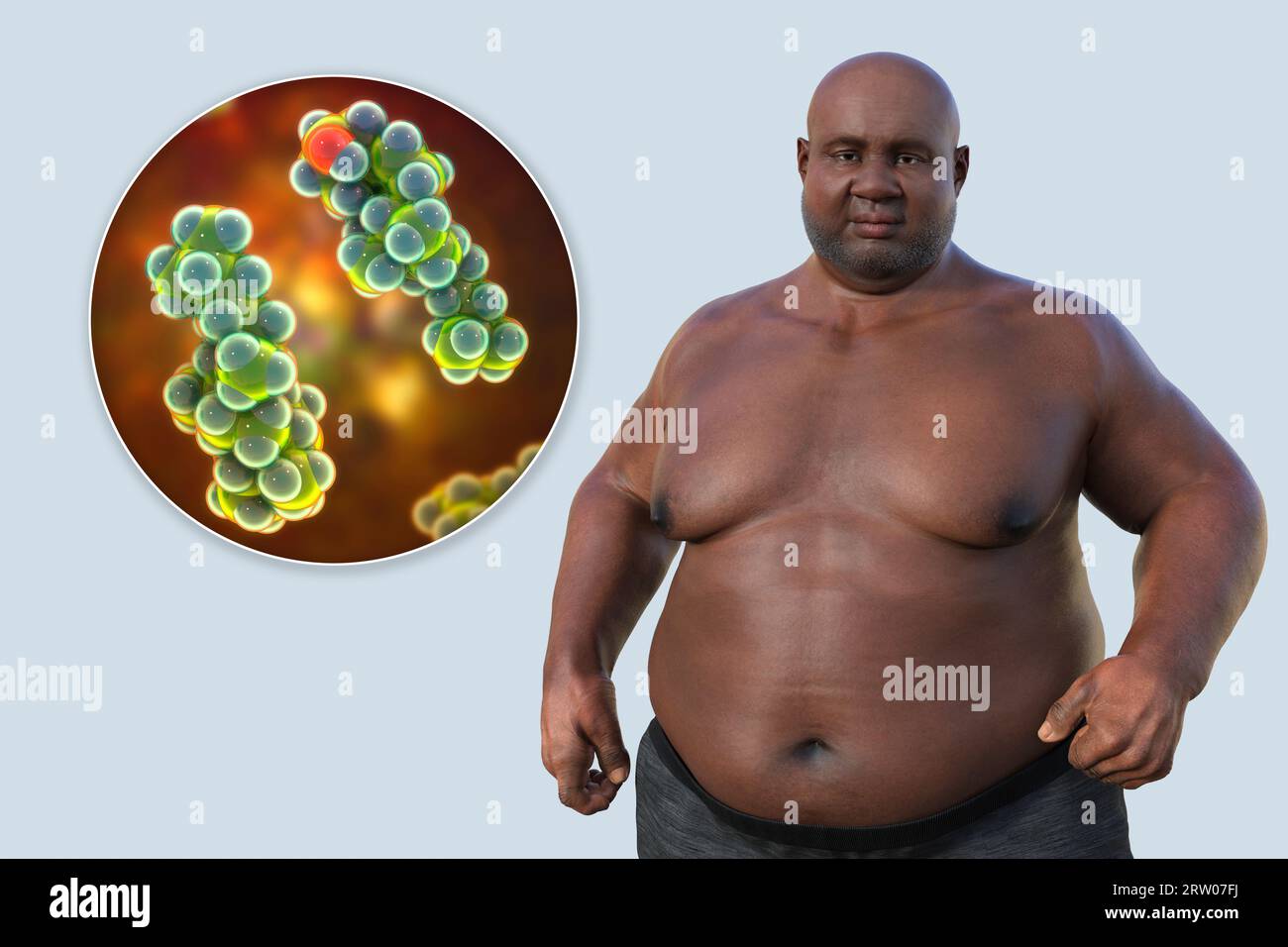 Fat white man hi-res stock photography and images - Alamy