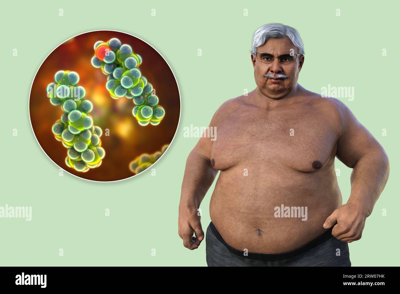 Overweight senior man hi-res stock photography and images - Alamy