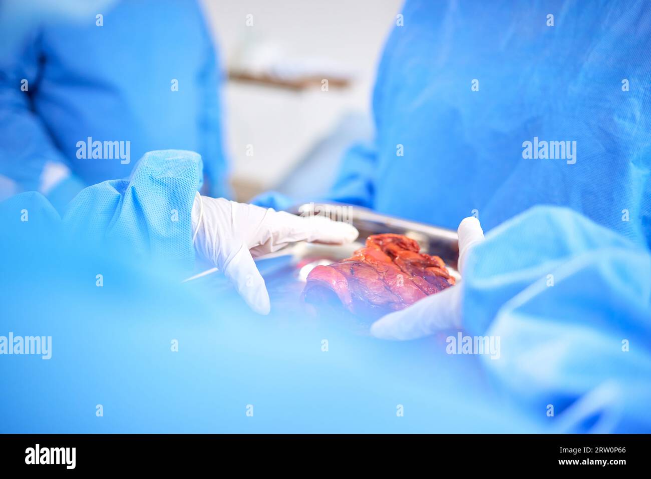 Organ transplant, hands and doctor surgery, medical support or teamwork ...