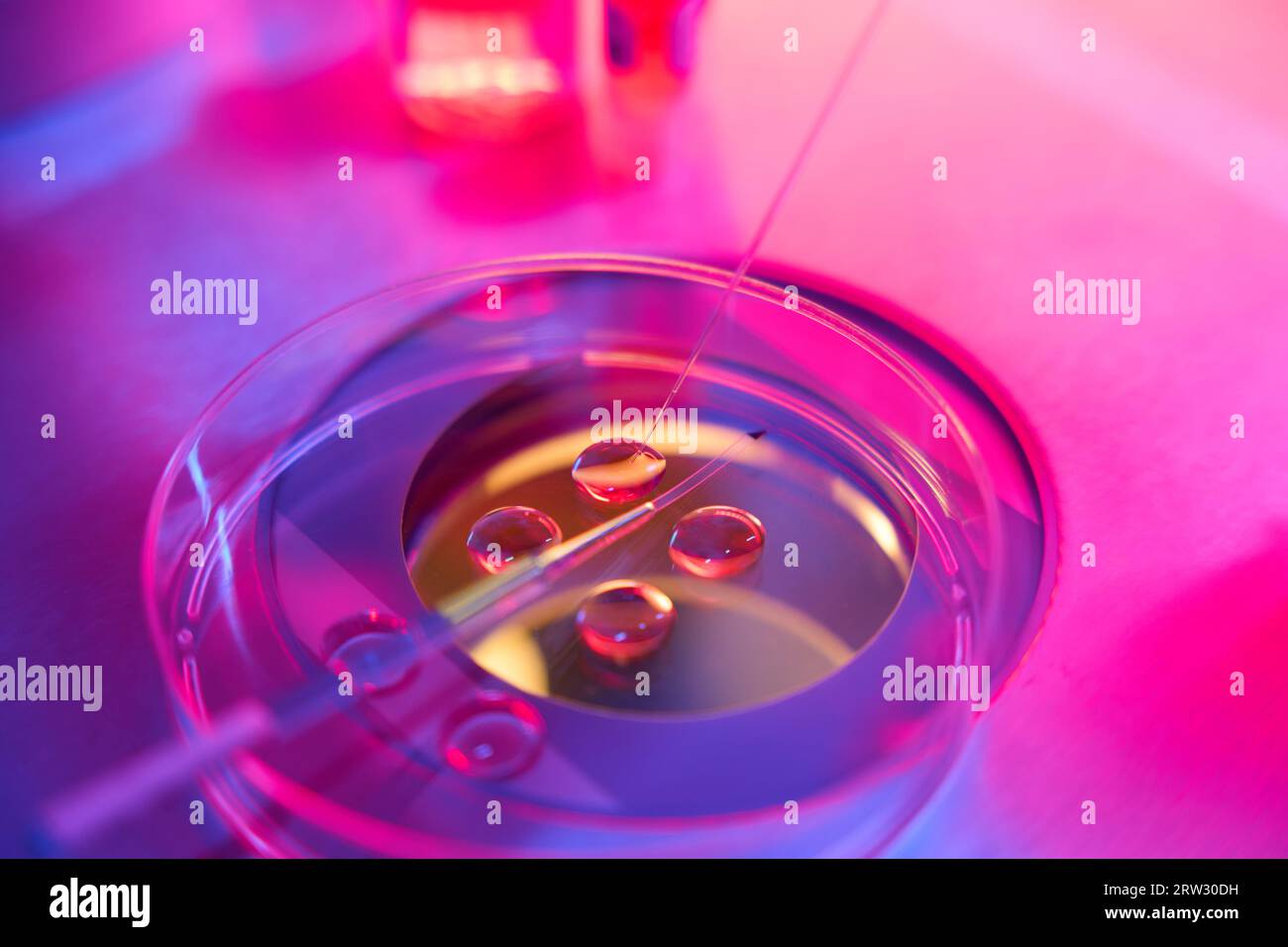 Biotechnological ICSI procedure in a modern laboratory Stock Photo - Alamy