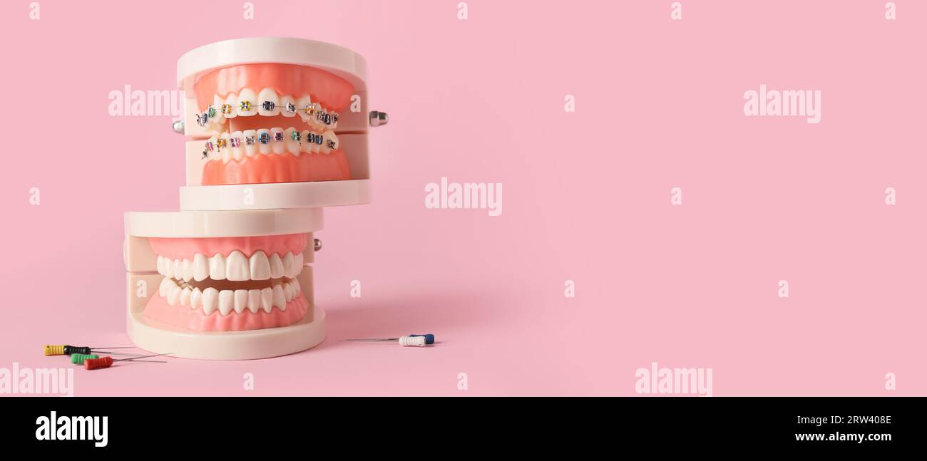 Plastic jaws with dental braces on pink background with space for text ...