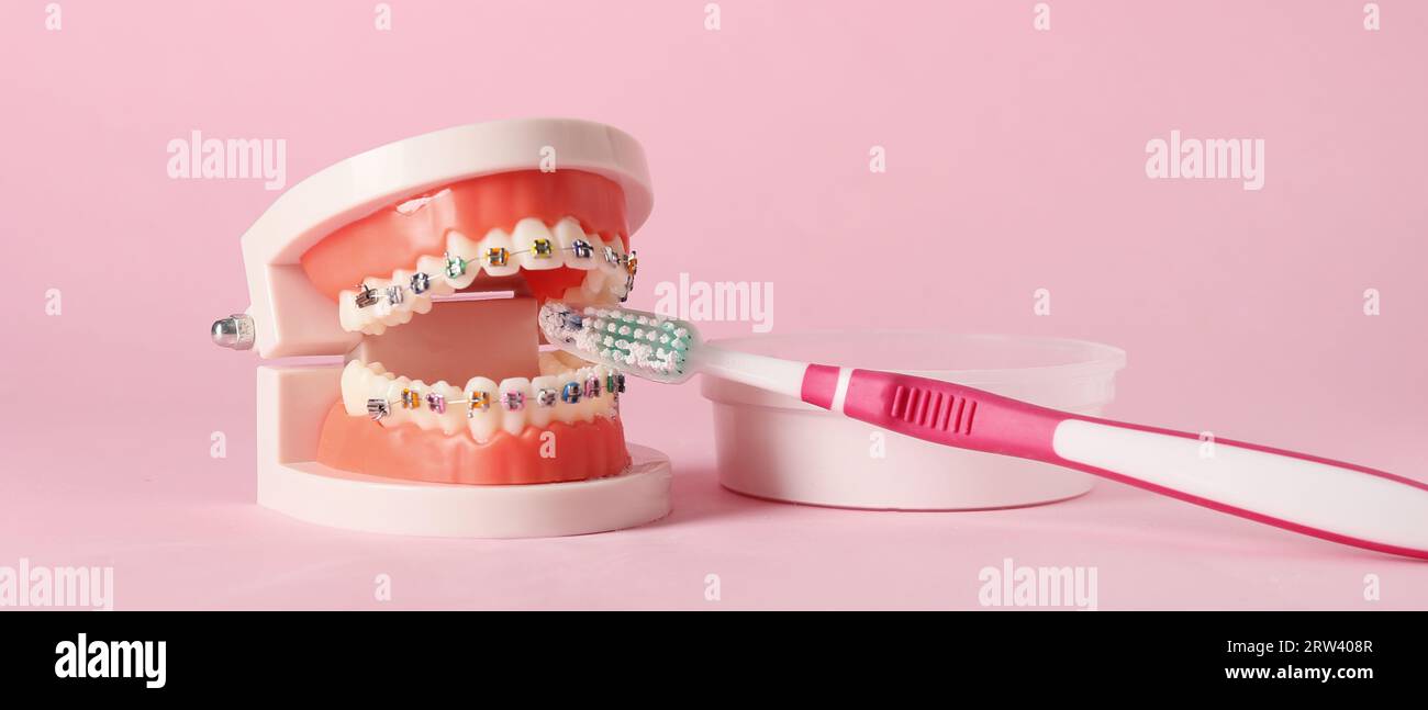Plastic jaws braces dental hi-res stock photography and images - Alamy