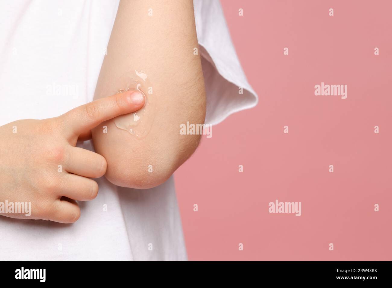 Child applying ointment onto elbow against pink background, closeup ...