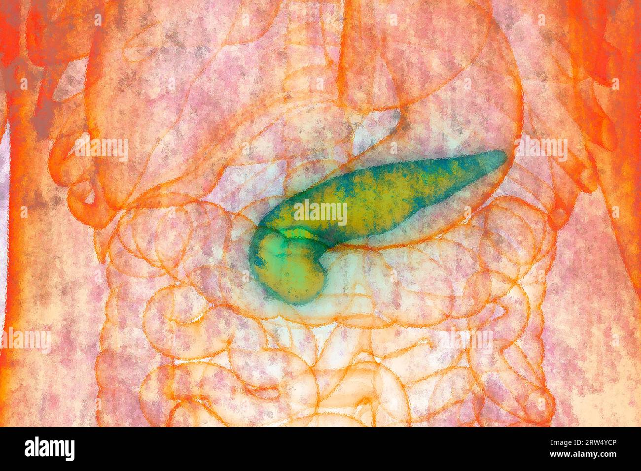 The pancreas is a wedge-shaped organ about 15 cm long, located behind ...