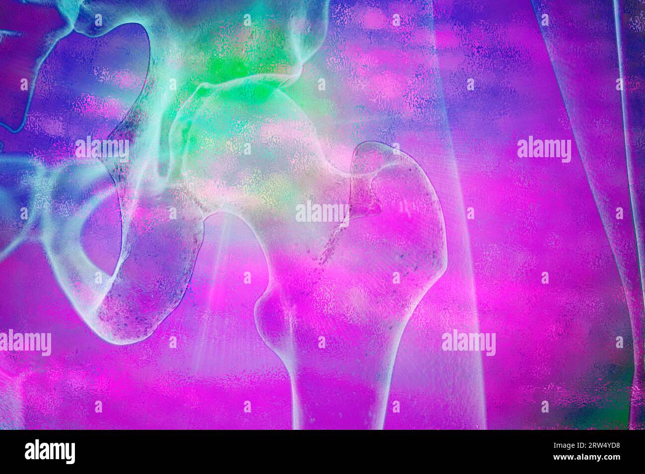 Ball and socket joint hi-res stock photography and images - Alamy