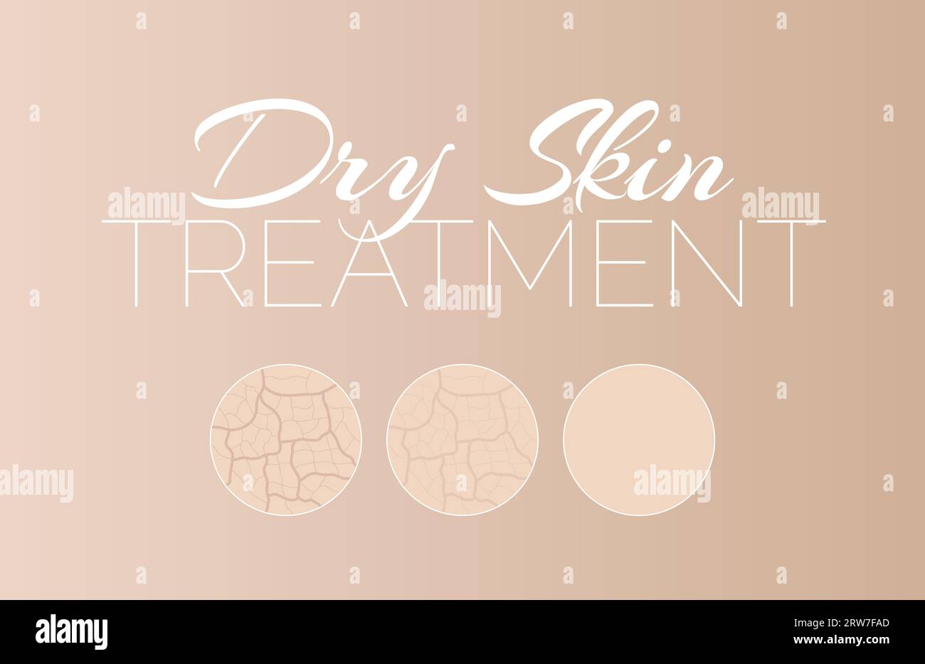 Surface treatment Stock Vector Images - Alamy