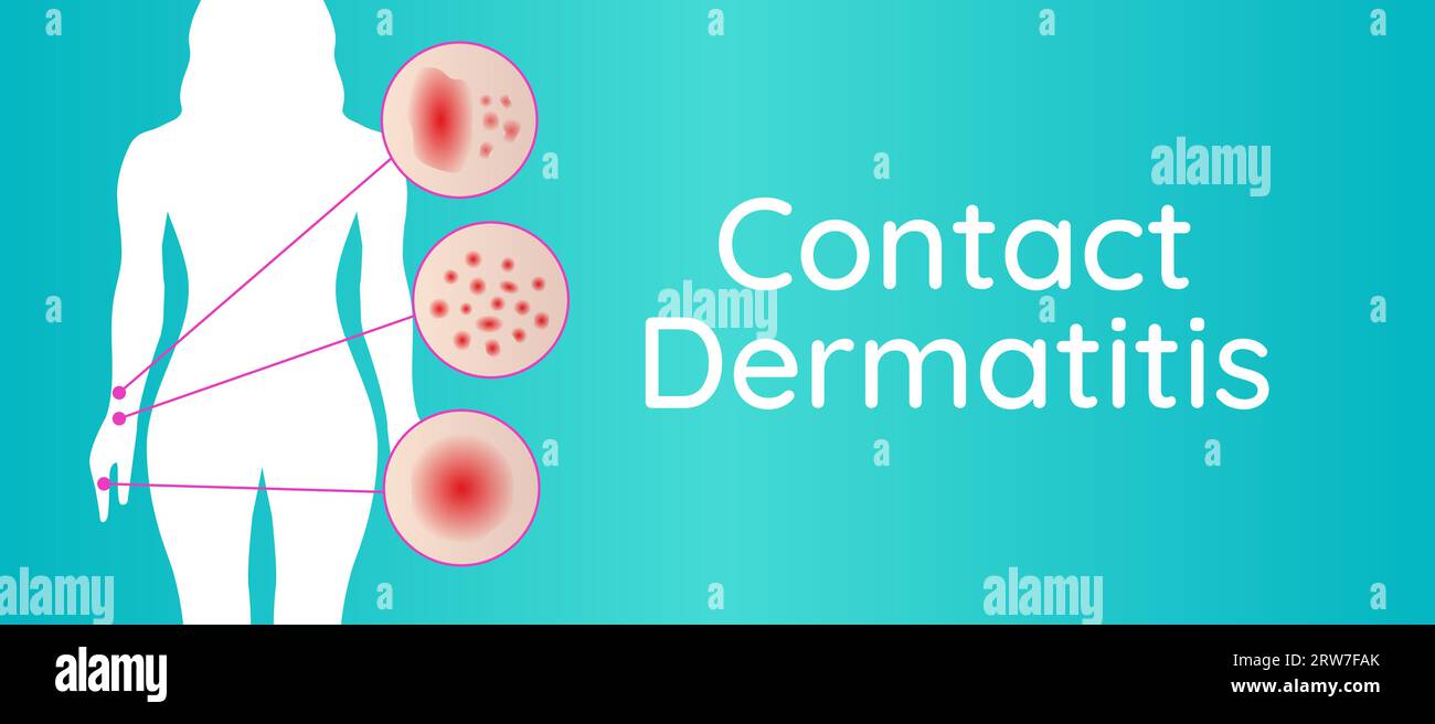 Closeups Stock Vector Images - Alamy