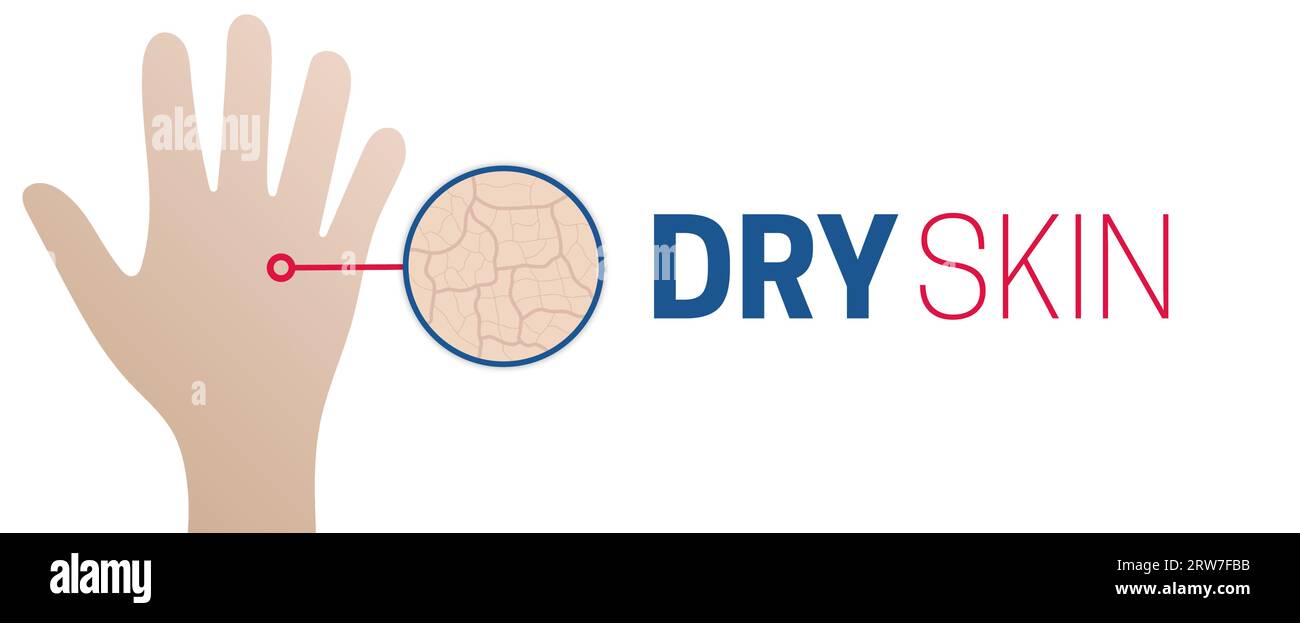 Dry Skin Medical Style Background Illustration Design Stock Vector ...