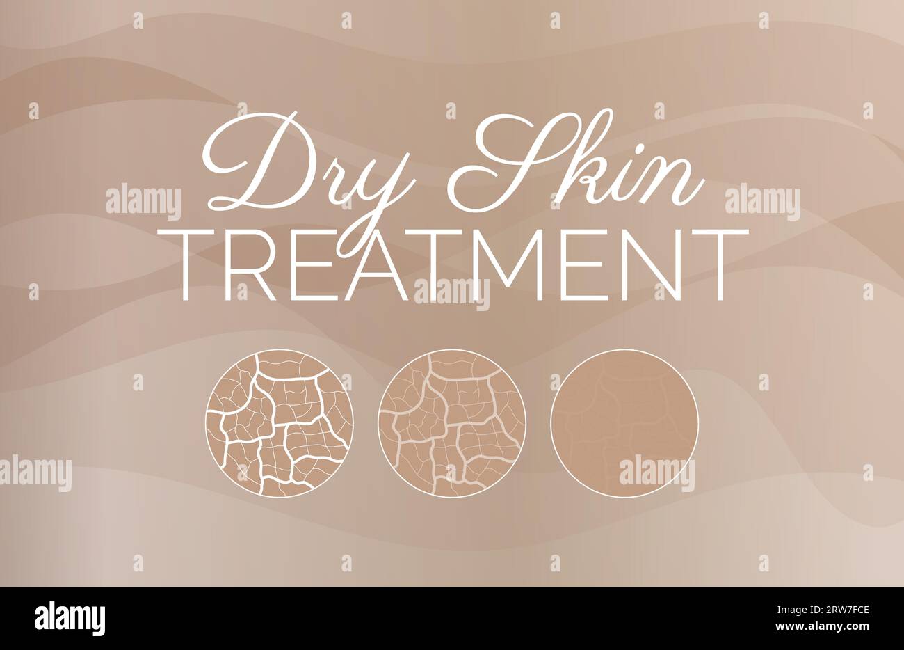 Surface treatment Stock Vector Images - Alamy