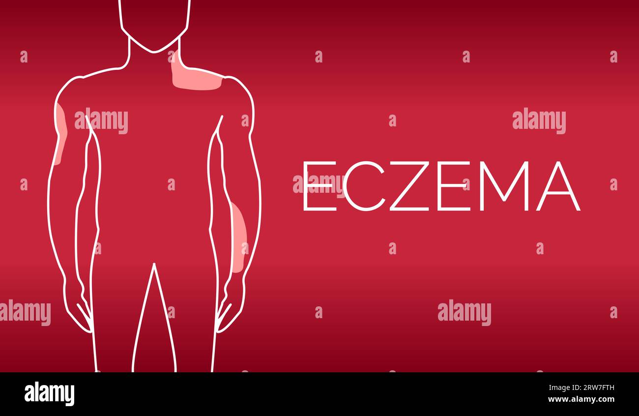 Red Eczema Background Illustration Design Stock Vector Image And Art Alamy
