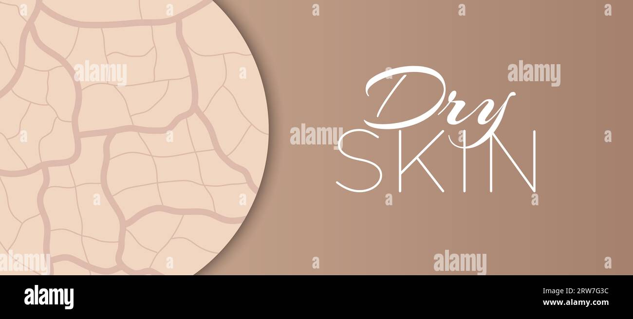 Dry skin Stock Vector Images - Alamy