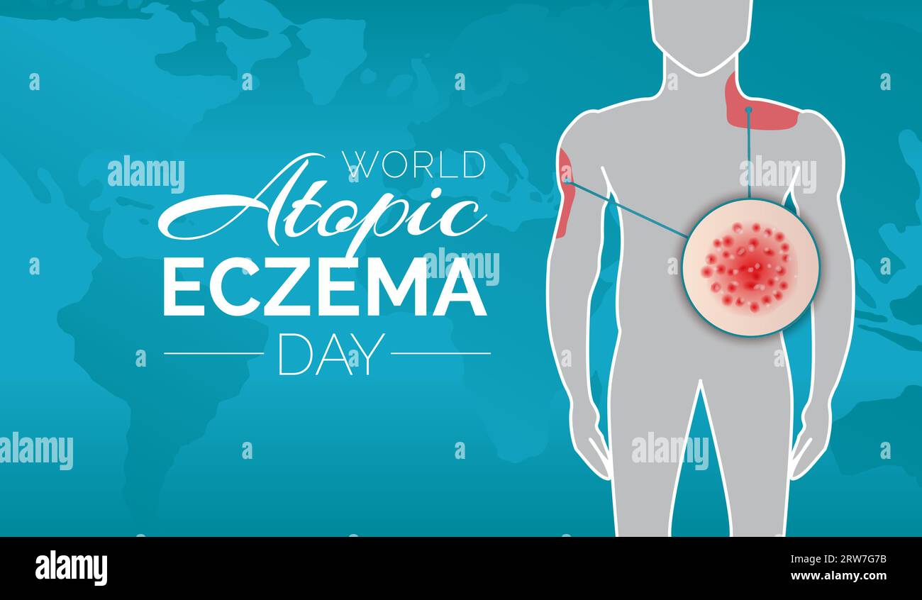 World Atopic Eczema Day Background Illustration Design With A Man Stock