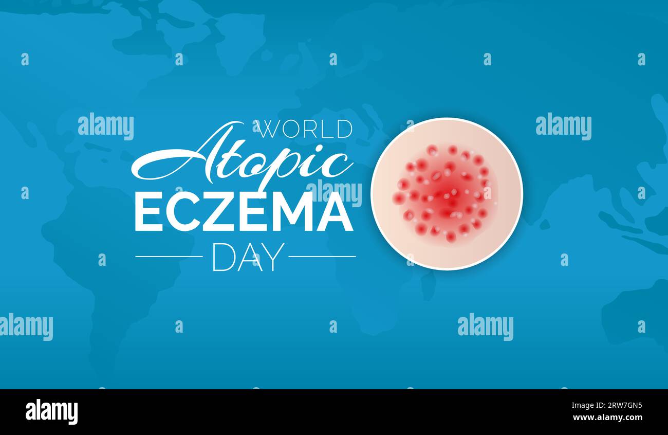 World Atopic Eczema Day Background Illustration Design Stock Vector